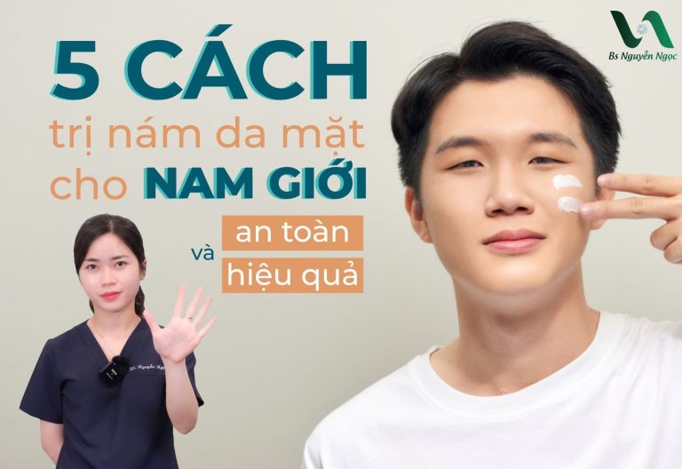 5 cách trị nám da mặt cho nam giới an toàn và hiệu quả